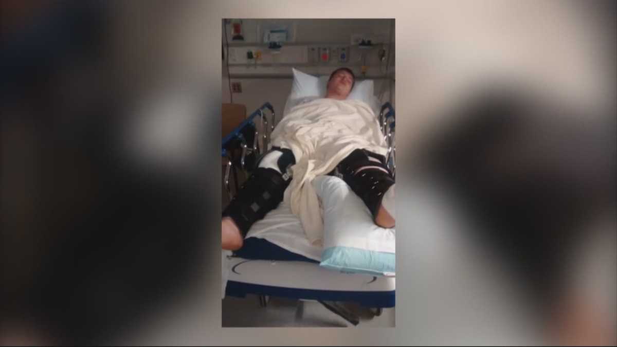 Teen breaks legs after being run over