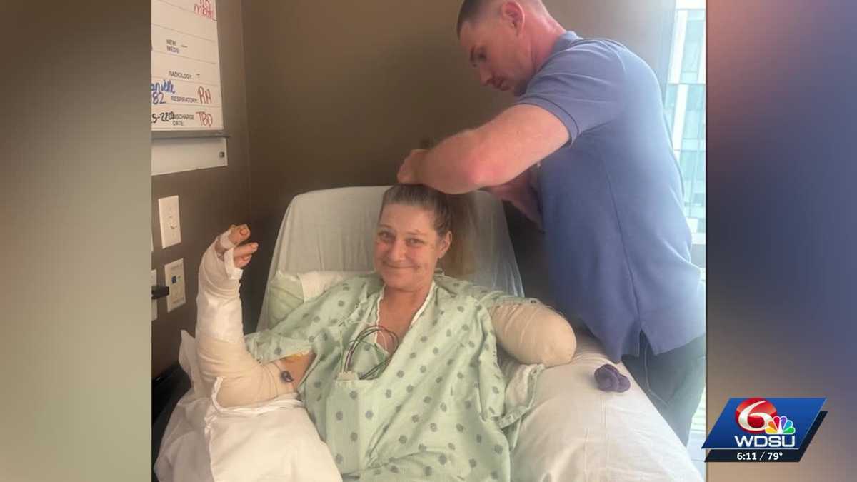 Woman survives after dog attacks her for more than an hour