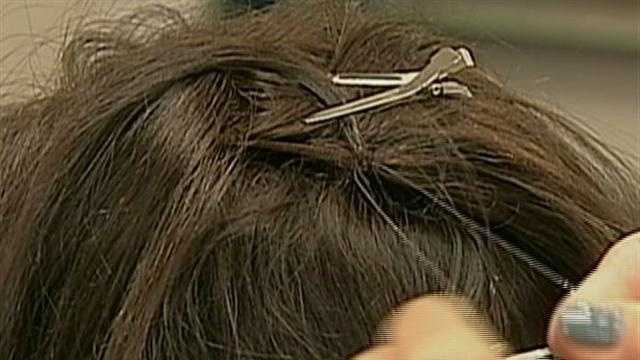 Chronic hair pulling disorder under-diagnosed and under-treated