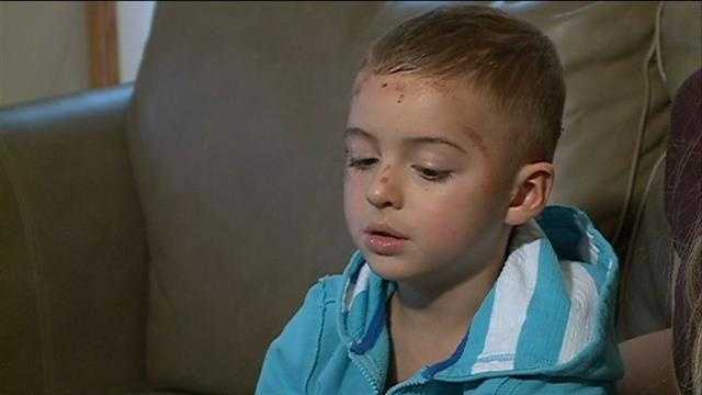 Omaha boy talks about being run over by car - KETV