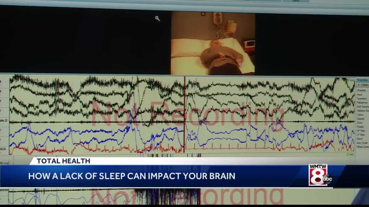 How a lack of sleep is affecting your brain
