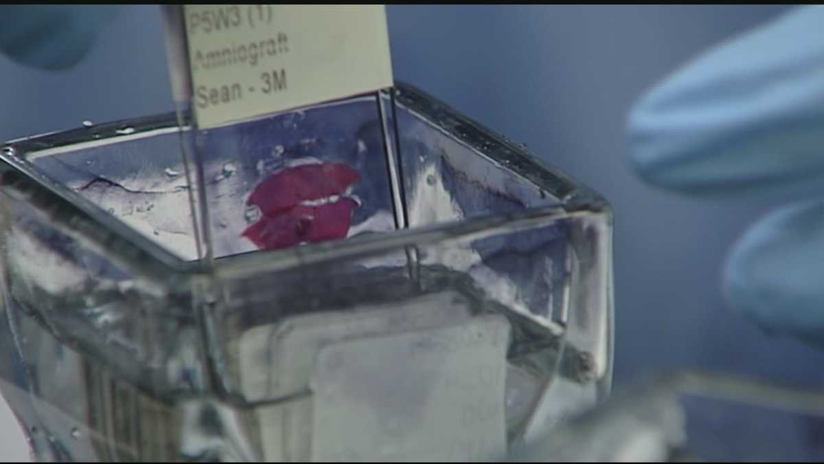 Regenerative Organs; Talitha Vickers reports