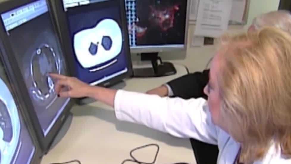 Lung Cancer Survival Rates Rise But Its Still The Leading Cause Of Cancer Death