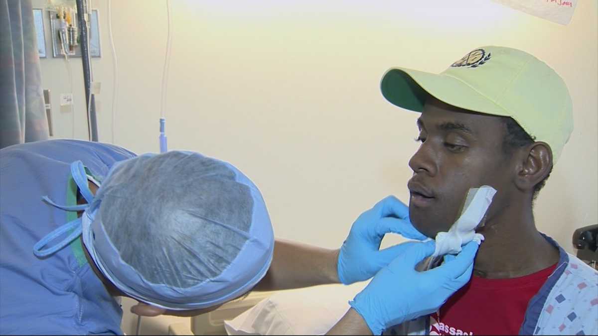 Haitian going home for Christmas after tumor surgery in Boston