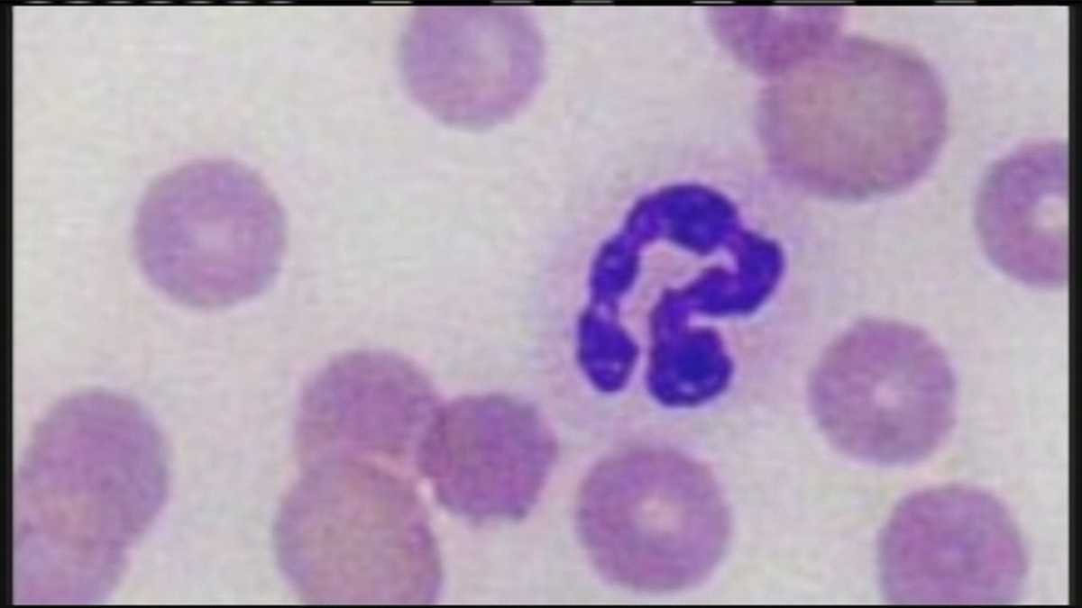 CDC warns against infection from deer ticks