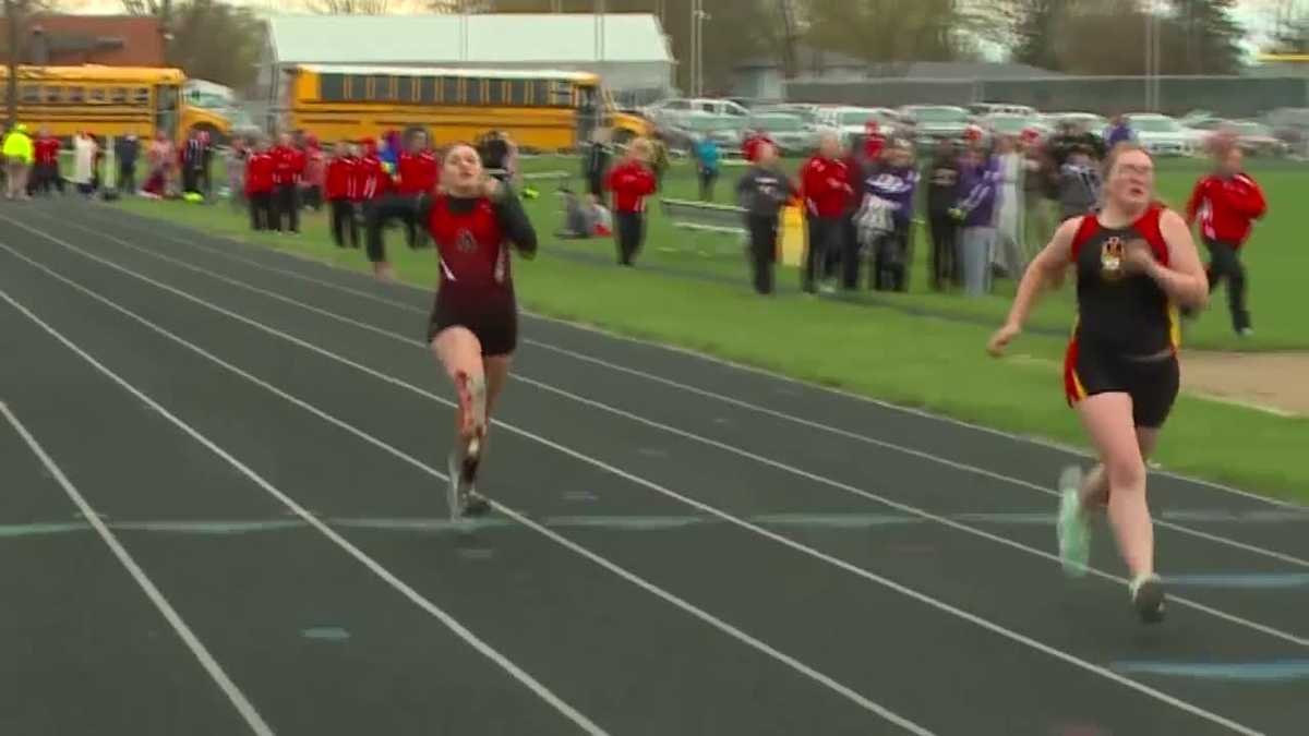 Back on track: Amputee makes great strides despite setbacks