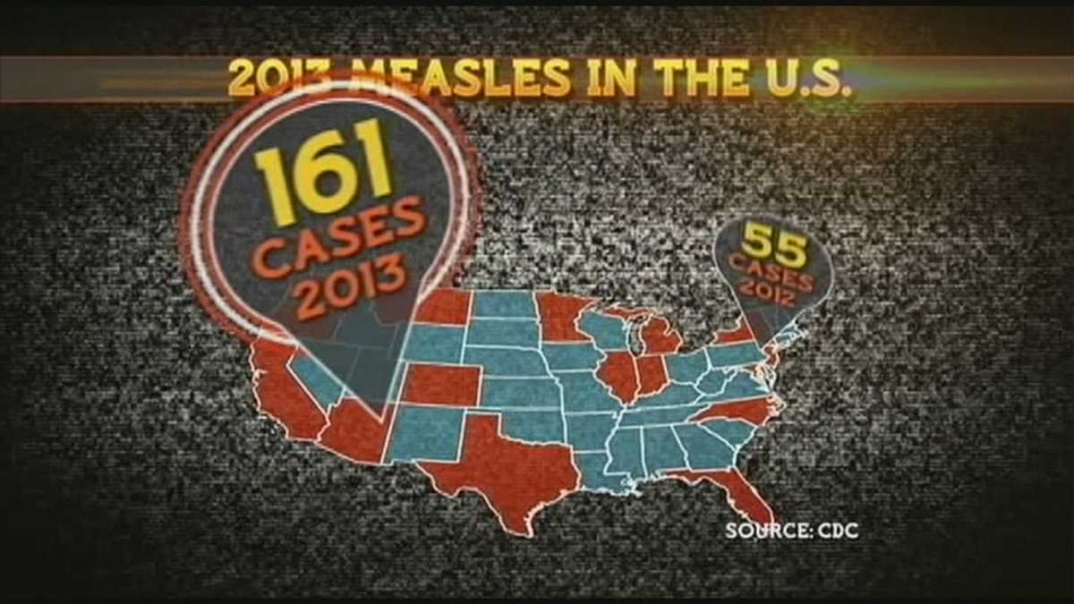 The Measles are making a Comeback