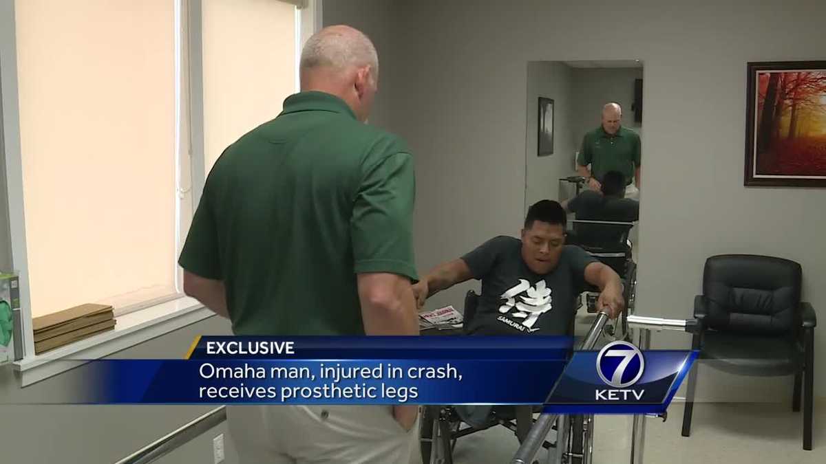 Omaha man injured in crash receives prosthetic legs