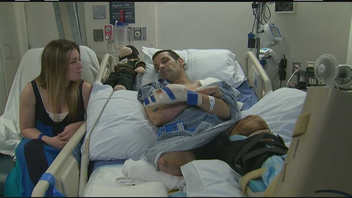 Marc Fucarile of Stoneham remembers every moment of bomb aftermath