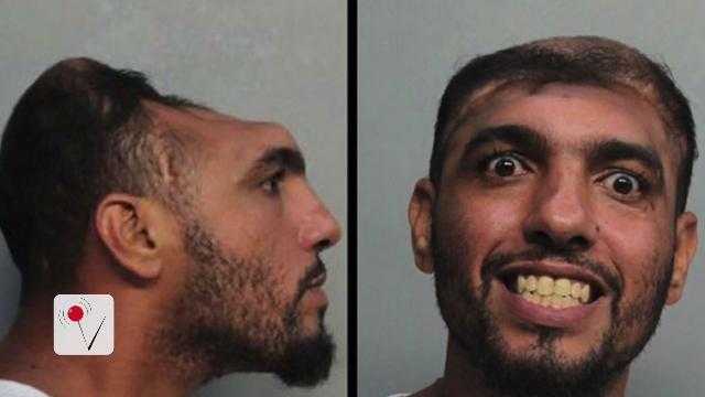 Man With Half a Head Arrested On Attempted Murder and Arson Charges