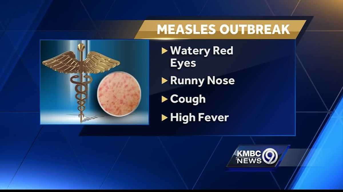 Measles: Know the risks, and the symptoms