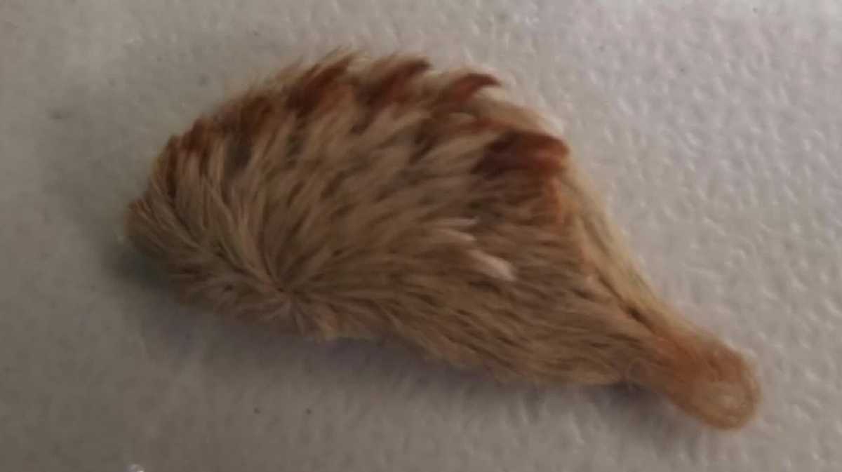 Woman shares warning after suffering 'excruciating' sting from ...