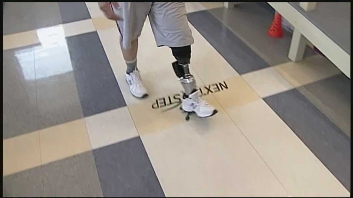 Prosthetic company offers hope to bombing victims