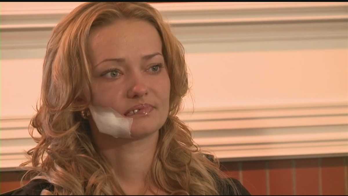 Woman recovering after reconstructive surgery