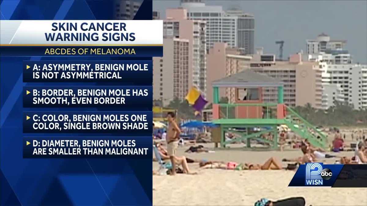 May is Skin Cancer Awareness Month