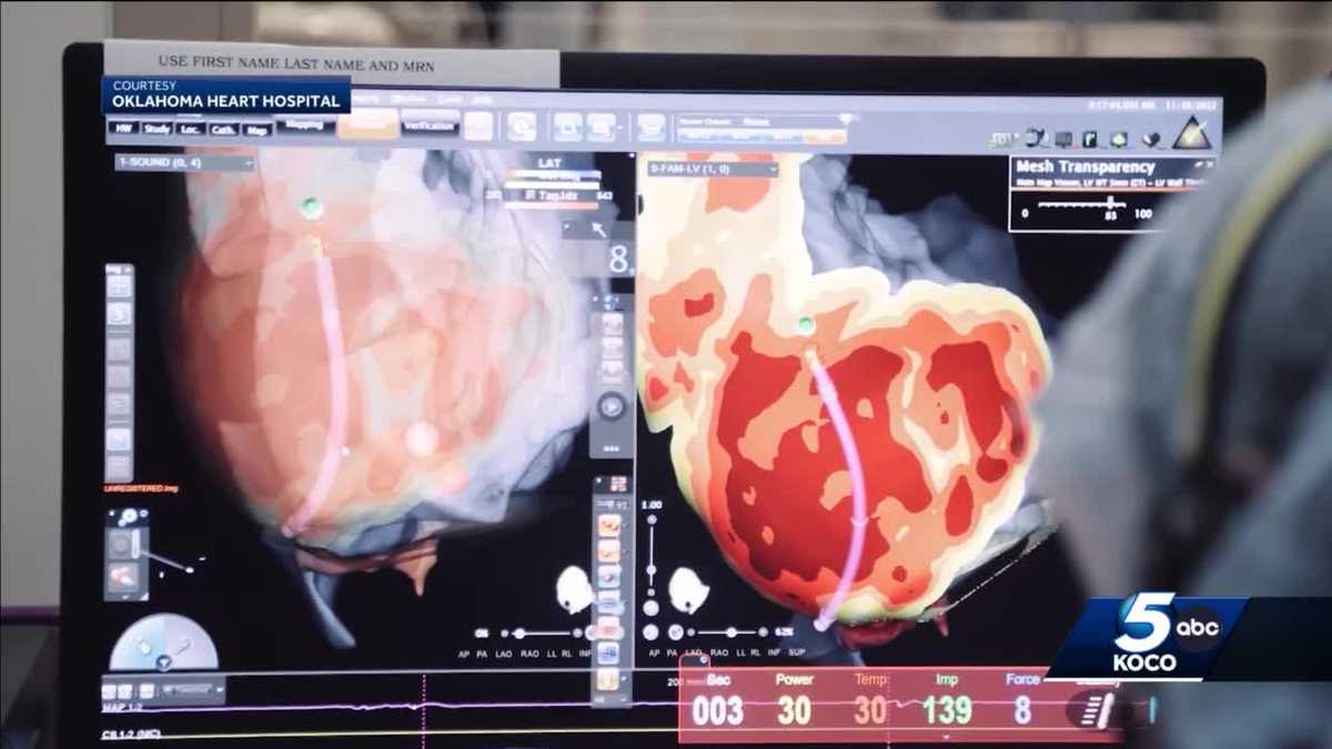 Oklahoma Heart Hospital using new life-saving procedure