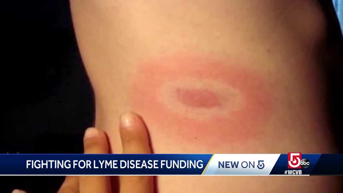 Mass. researcher's antibody work shows promise in fight against Lyme ...