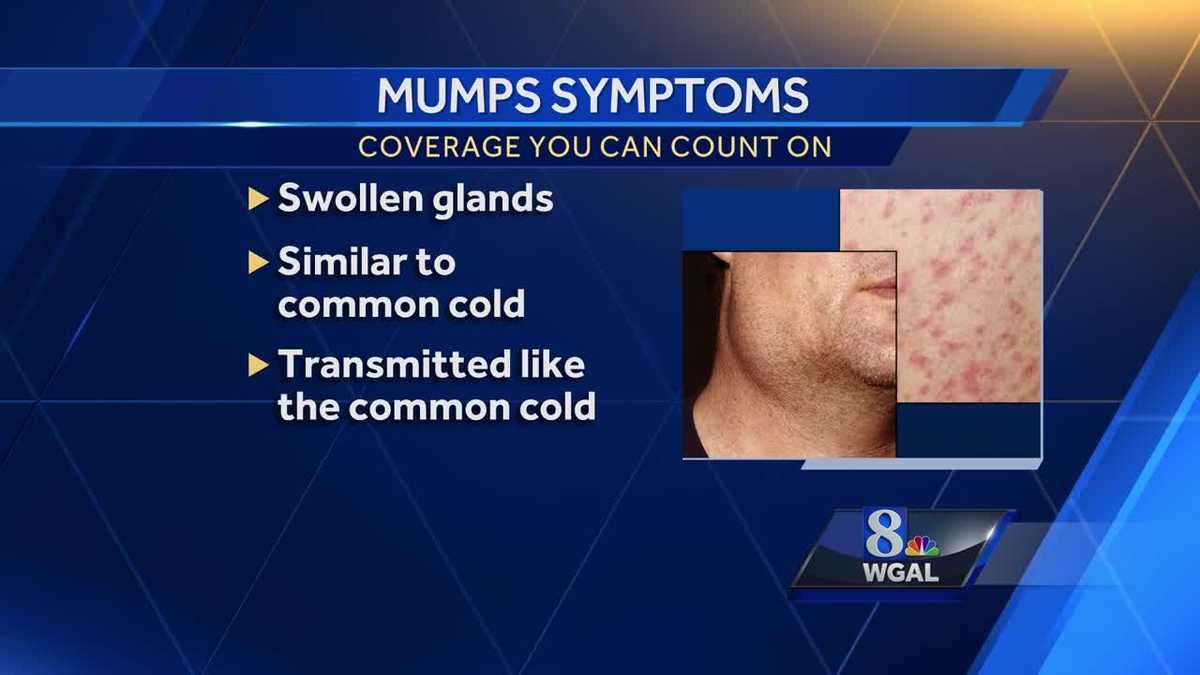 3 cases of mumps reported at Penn State; Advisory goes out before THON