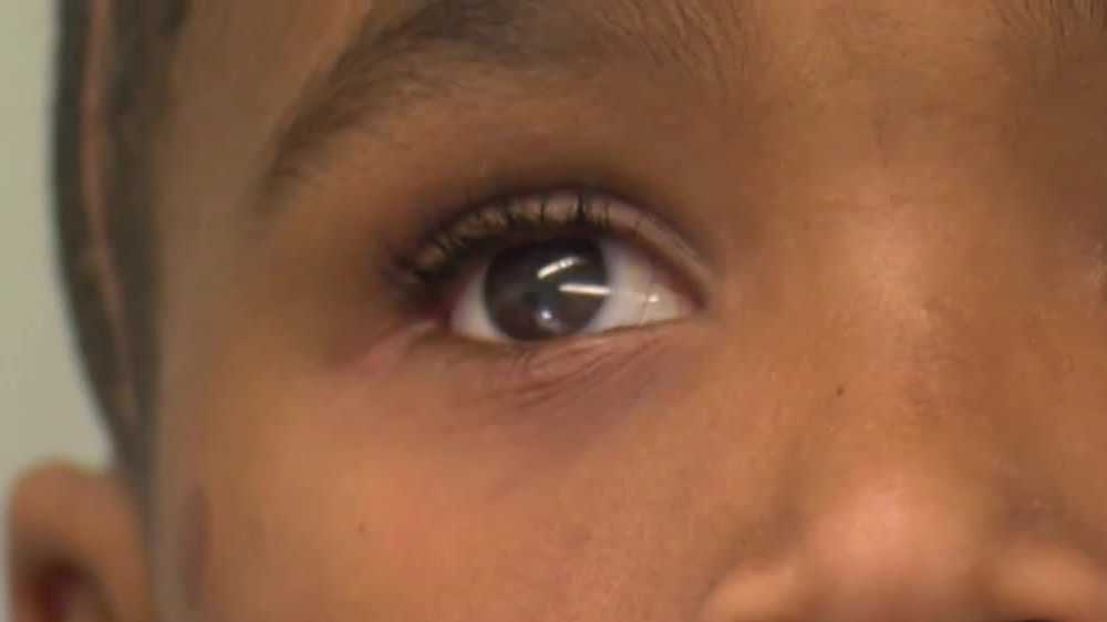 Kentucky boy gifted prosthetic eye after 2020 shooting leaves him blind