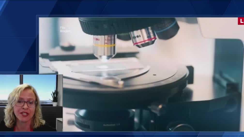 UW Health: Alzheimer's drug breakthrough?