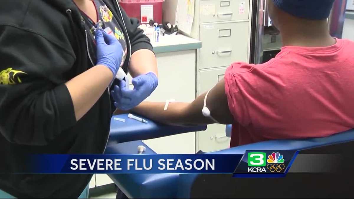 Flu cases on the rise in California
