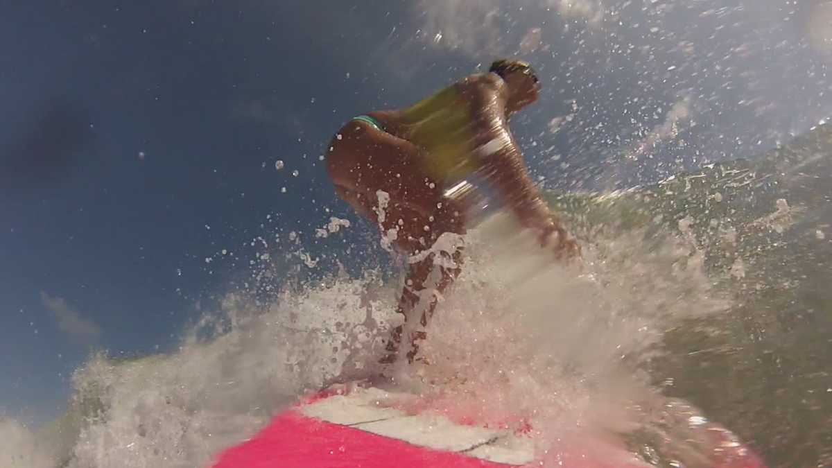 Surfer overcomes shark bite, severe eye injury