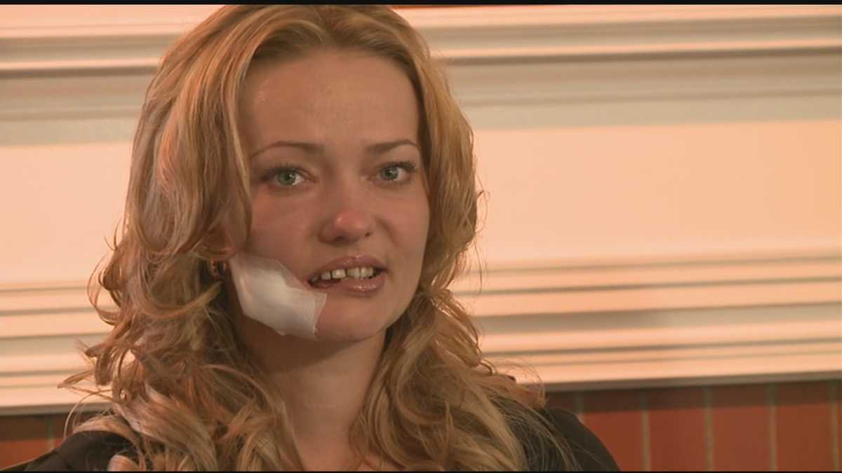 Lessya's Story: Woman disfigured by medical mistake gets second chance