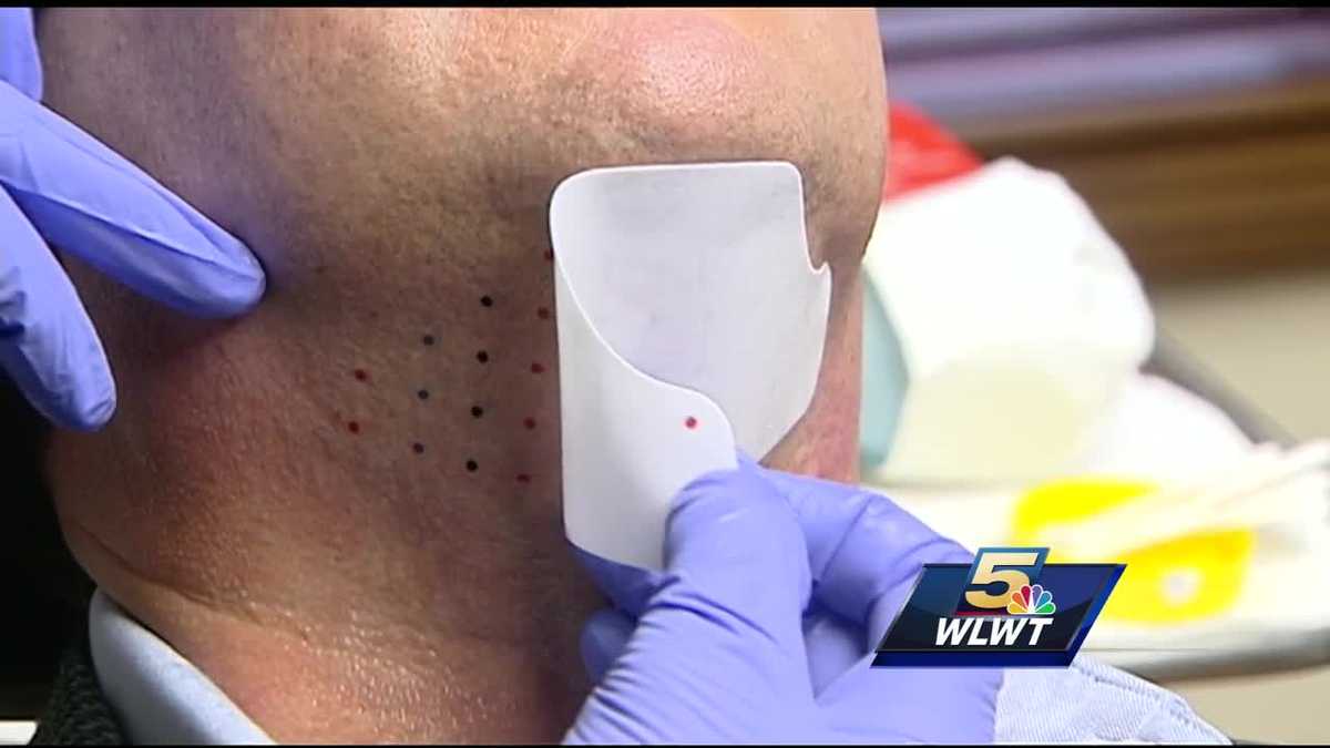 Makeovers for men: Non-invasive procedure eliminates fat from neck up
