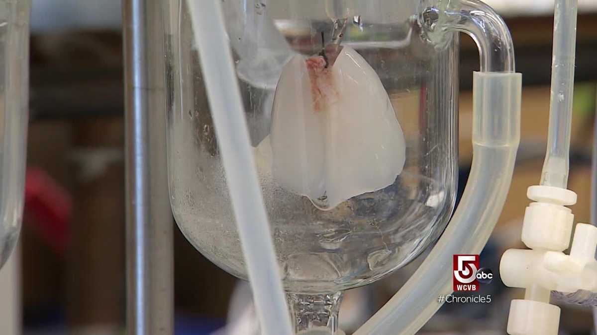 Organs made on demand