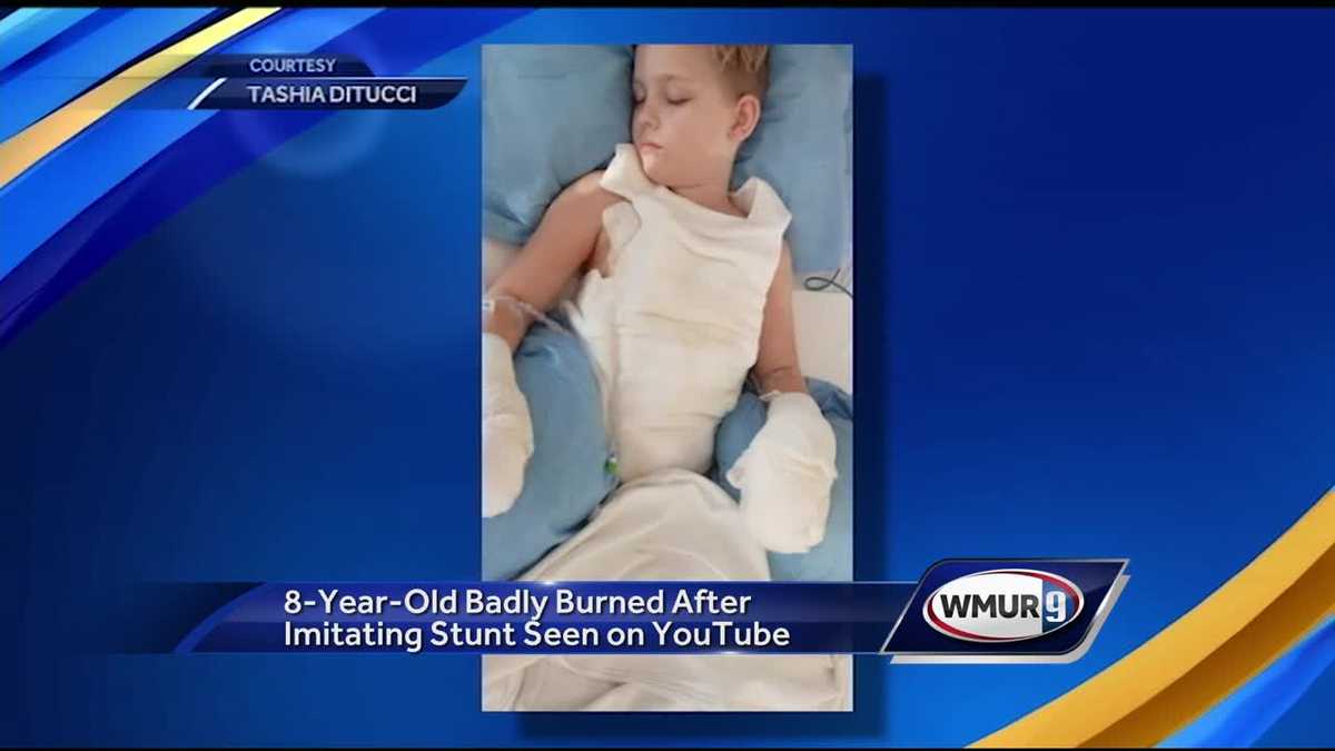 Boy seriously injured trying to imitate YouTube stunt