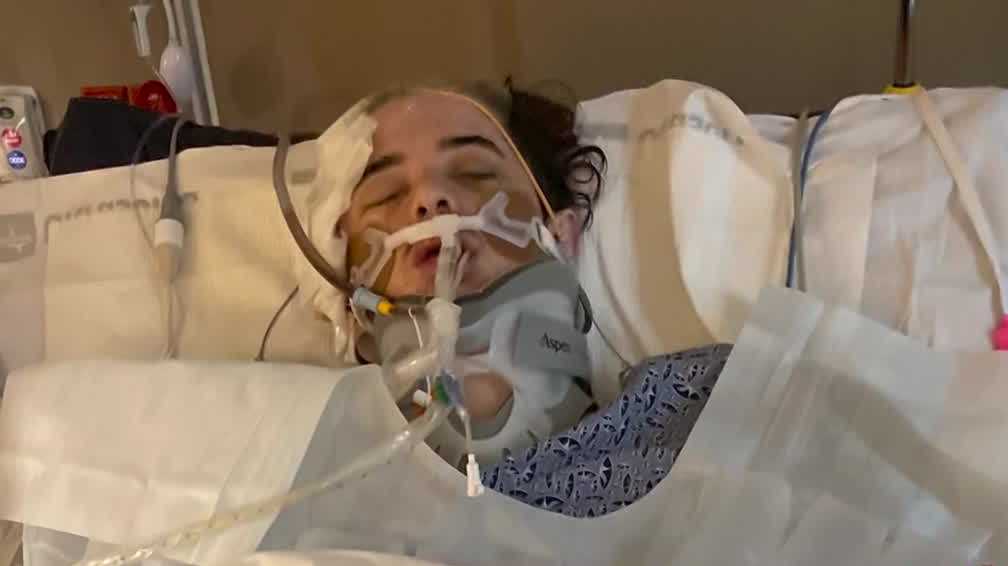Orlando hit-and-run crash that left teen in coma remains unsolved
