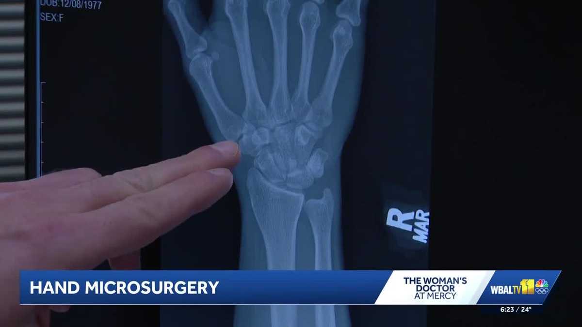 Mercy Medical Center: Microsurgery, explained