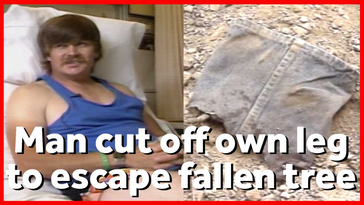 Man trapped under tree cut off own leg in 1993