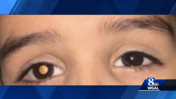 KNOW THE GLOW: Pa. Lt. governor's family shares child's story