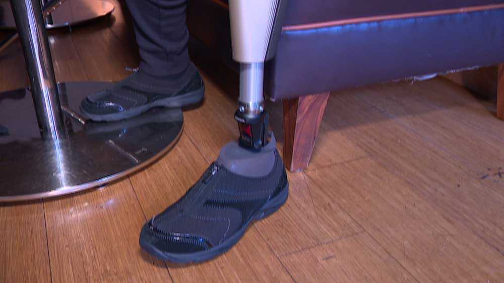 Boston Marathon bombing survivor Heather Abbott providing prosthetic ...