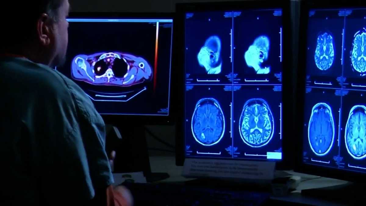 BU study may help develop way to diagnose CTE in living patients