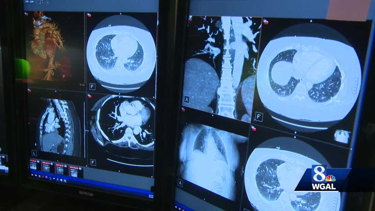WellSpan Health uses AI to detect abnormalities in medical scans