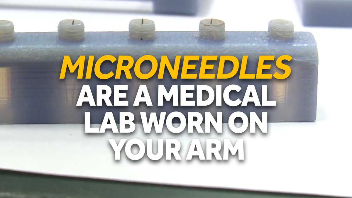 New "microneedle" technology functions like a medical lab worn on the arm