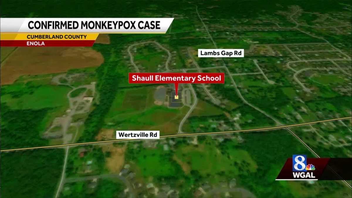 Person with monkeypox was in Cumberland Valley school, superintendent says