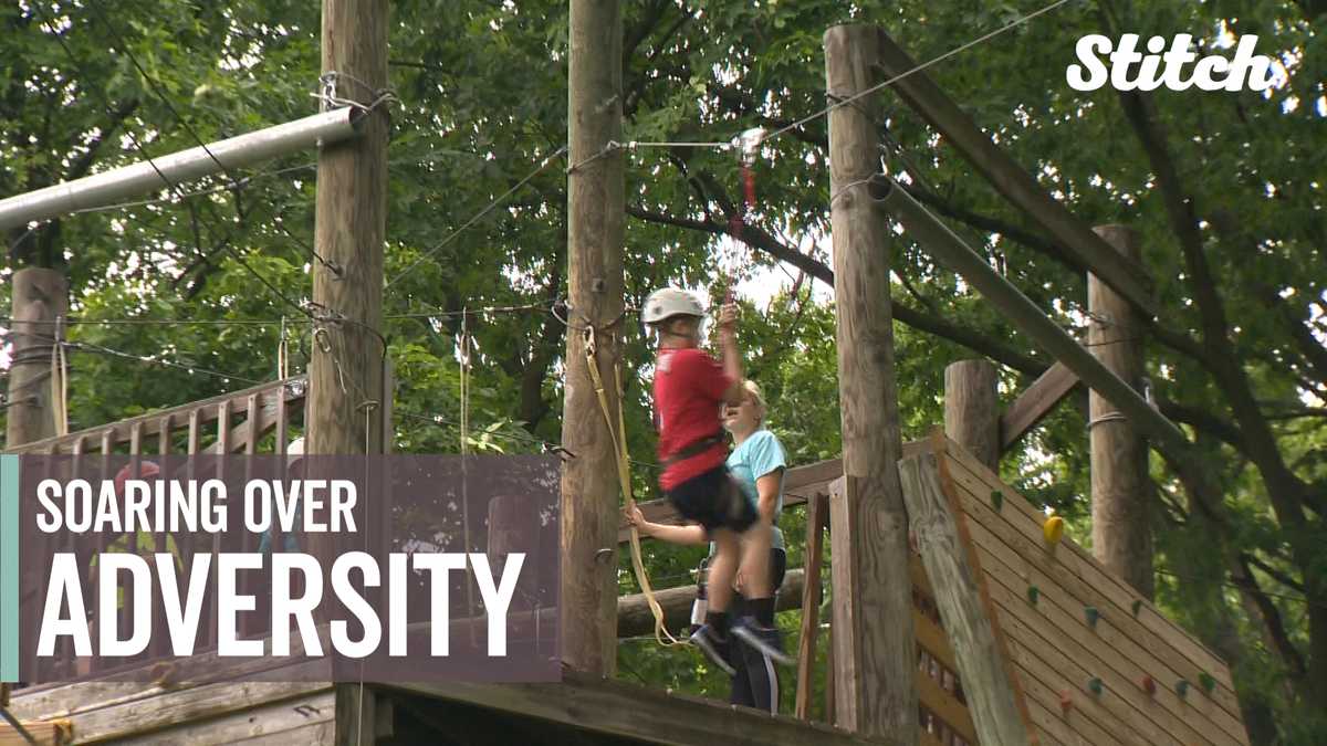 Camp helps young burn victims overcome injuries