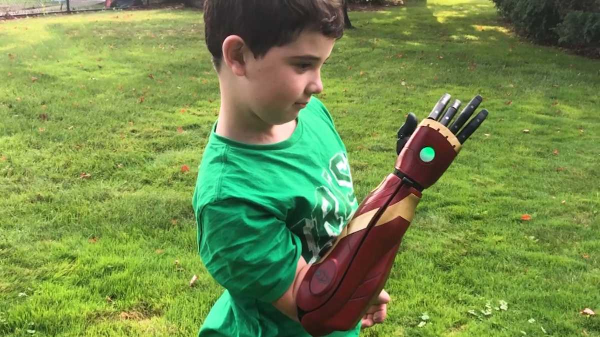 8-year-old's bionic 'Hero Arm' saves his future