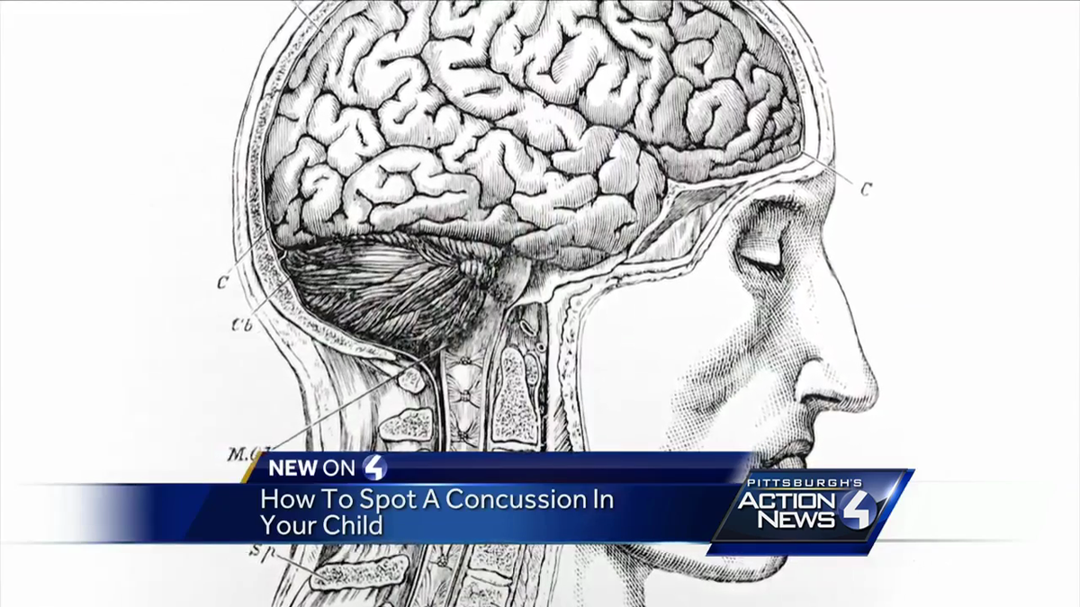 How to spot a concussion in your child