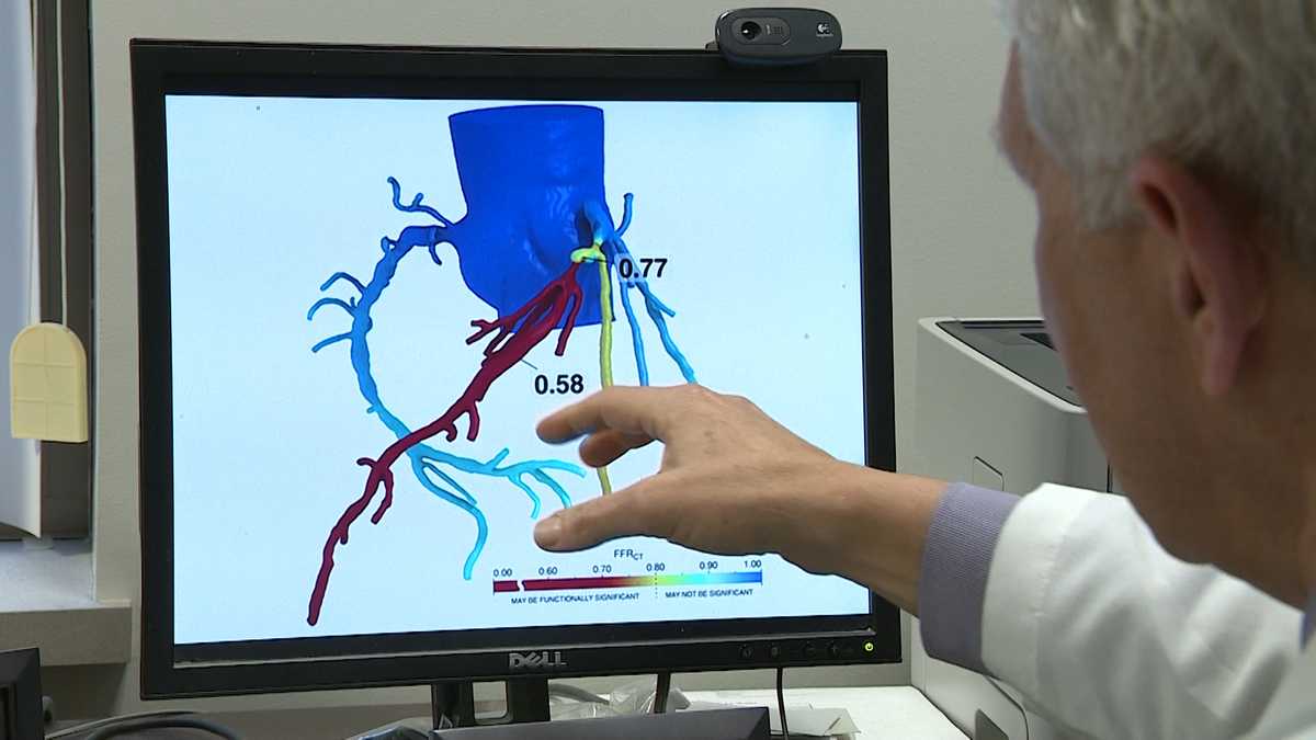 3D technology helping doctors better diagnose, treat patients